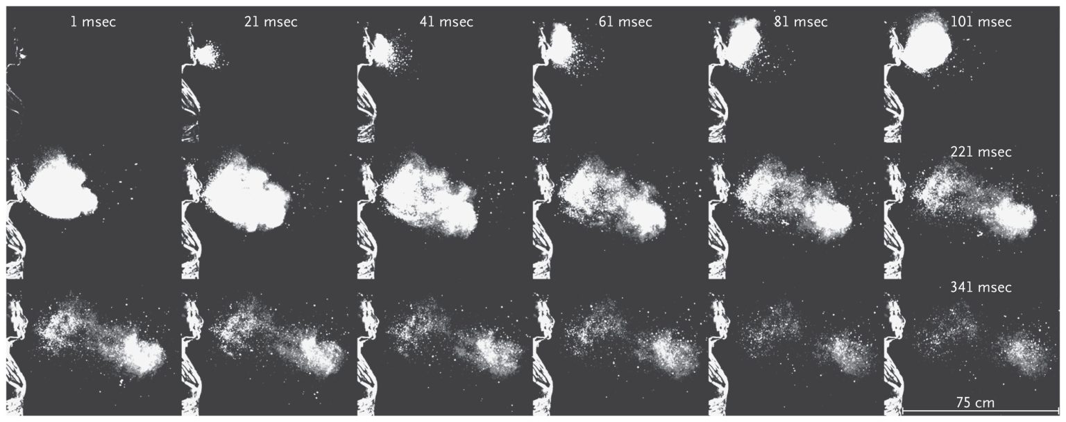 How Fast Does a Sneeze Travel? You’ll Be Surprised - iEnglish Status